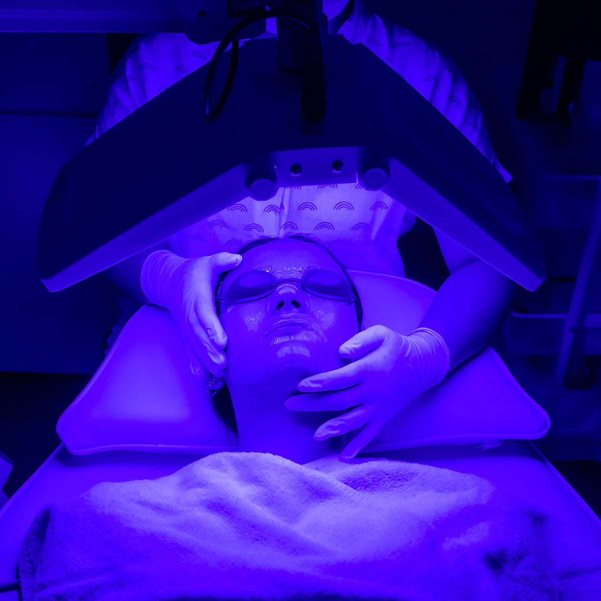 Why Blue Light is Bad for Hyperpigmentation: What Every Esthetician Sh ...